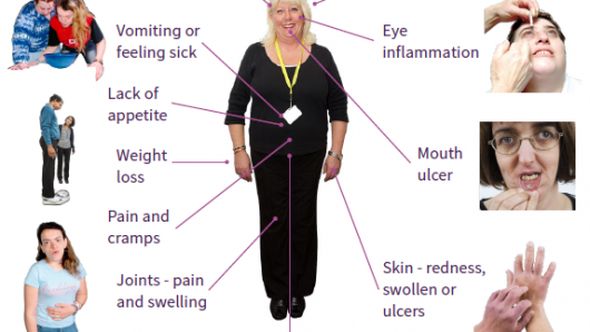 VoiceAbility | Communicating about your IBD symptoms